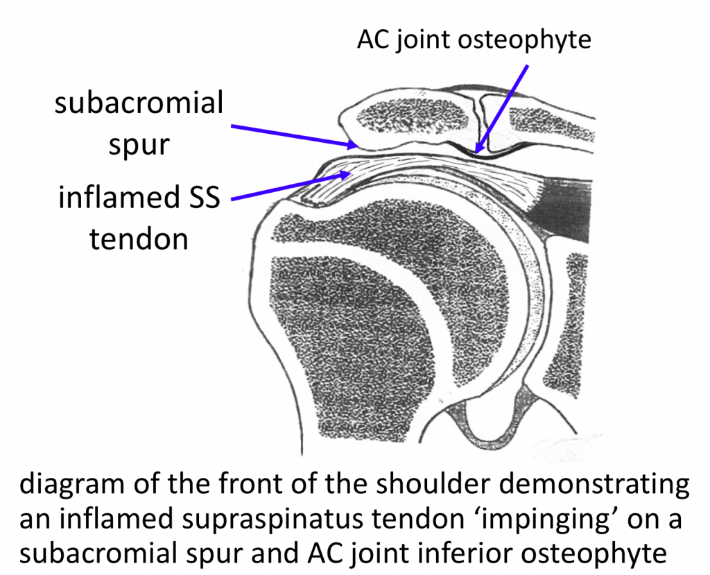 The Rotator Cuff – Hannan Mullet